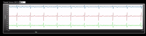 QuSpin & Mansfield Imaging Centre Advance Neuroscience with Highly ...
