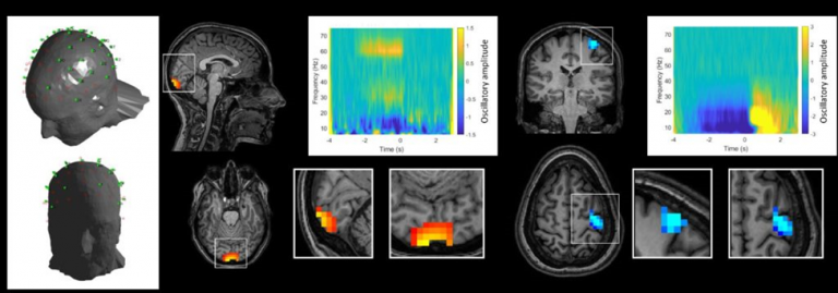 QuSpin & Mansfield Imaging Centre Advance Neuroscience with Highly ...