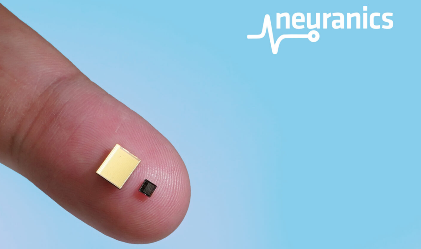 Neuranics: Glasgow Spin-out Develops Tiny TMR Sensors for Biomagnetic ...